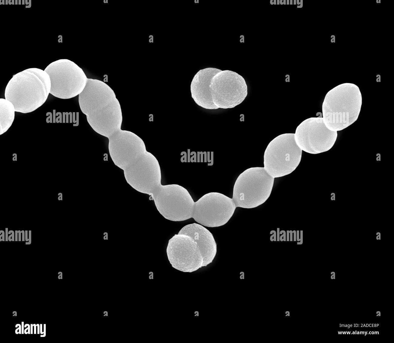 Scanning electron micrograph (SEM) of Streptococcus pneumoniae , Gram-positive, encapsulated ...