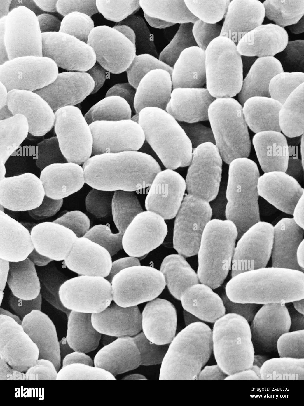 Bordetella Pertussis Electron Micrograph