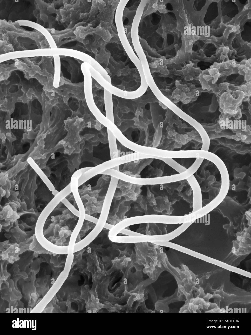Scanning electron micrograph (SEM) of Bacillus megaterium, Gram ... Scanning electron micrograph (SEM) of Bacillus megaterium, Gram ...