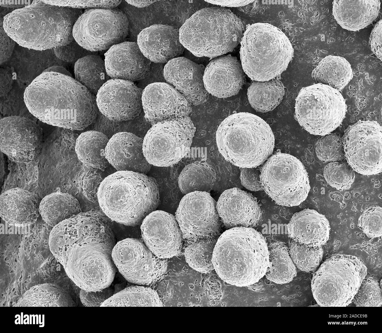 Scanning electron micrograph (SEM) of Thallus of a crustose lichen ...