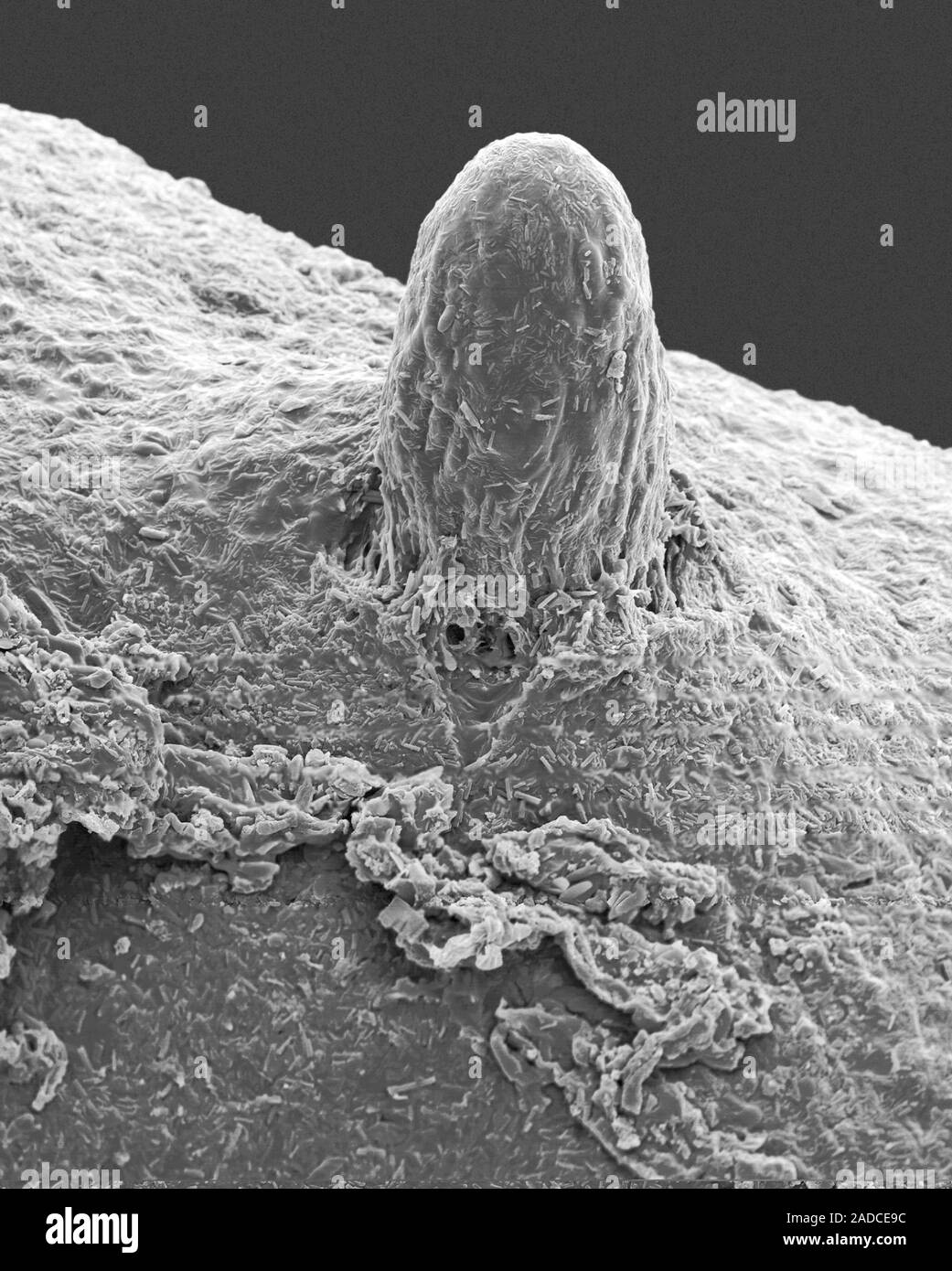 Scanning electron micrograph (SEM) of Thallus of a filamentous ...