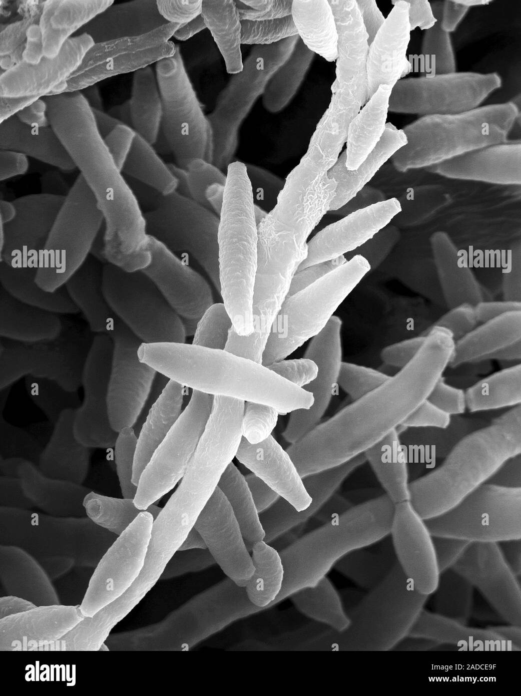 Scanning electron micrograph (SEM) of fungal hyphae and spores of the ...
