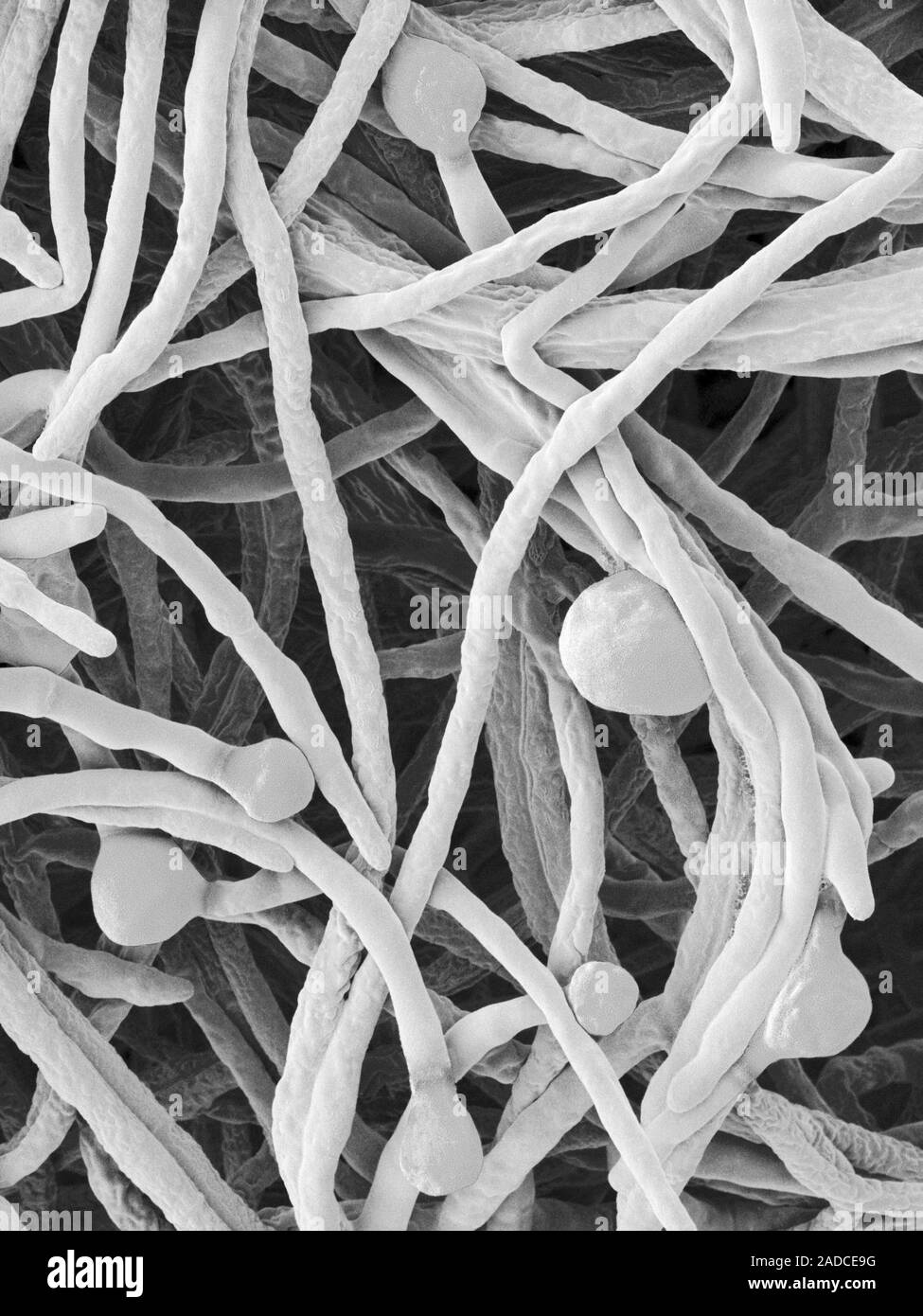 Scanning electron micrograph (SEM) of Phaeosphaeria microscopica is an ...