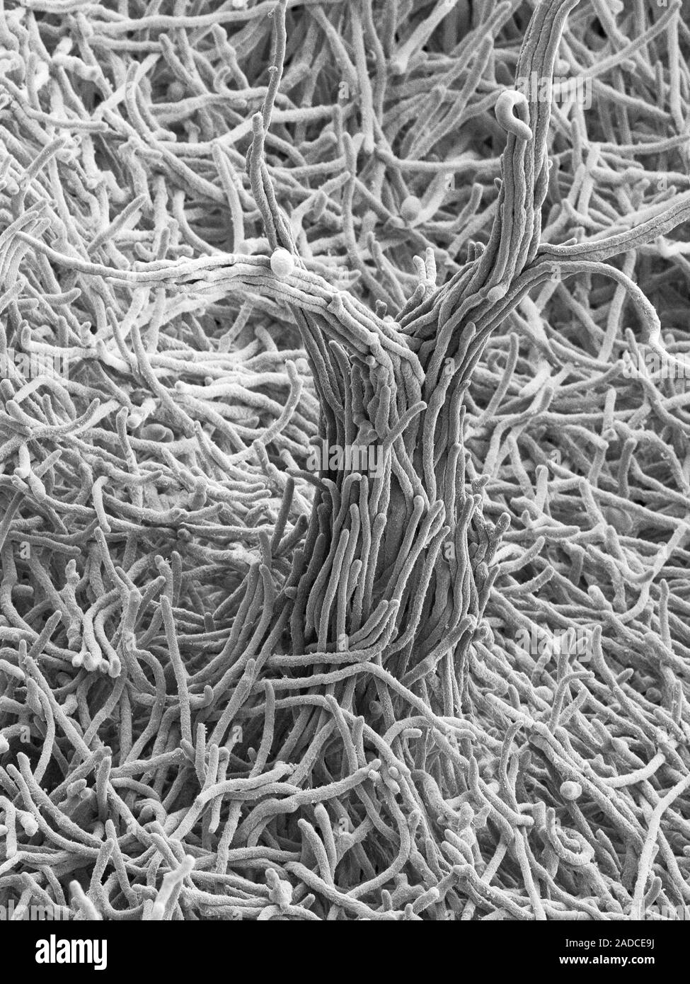 Scanning electron micrograph (SEM) of Exophiala spinifera is a ...