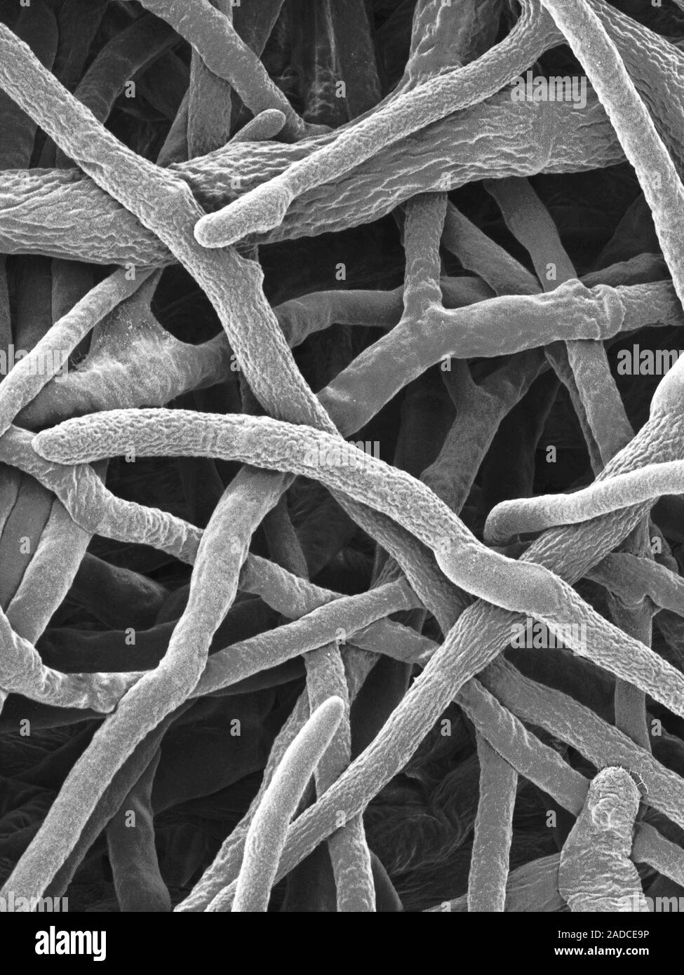 Scanning electron micrograph (SEM) of Irpex lacteus is a basidiomycete ...