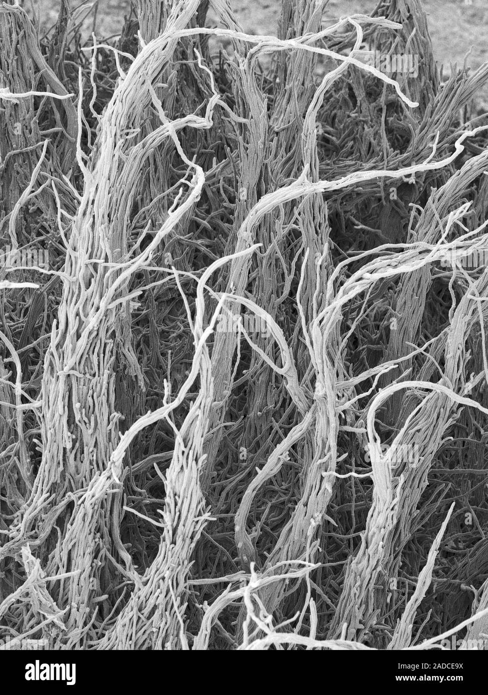 Scanning electron micrograph (SEM) of Pleurostomophora richardsiae ...