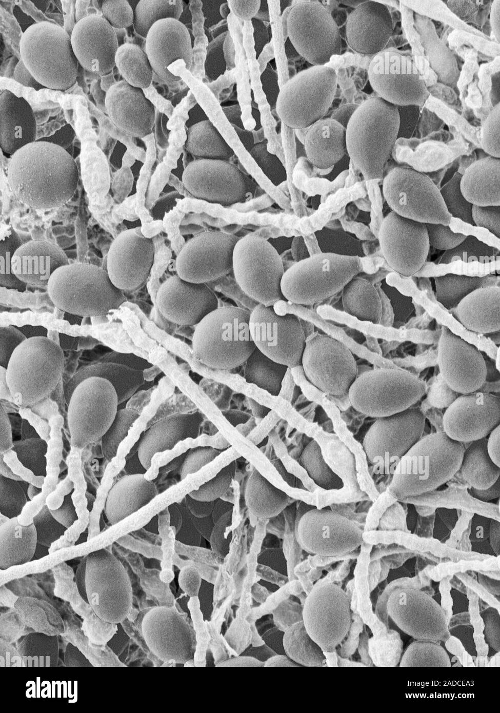 Scanning electron micrograph (SEM) of Scedosporium prolificans, a ...
