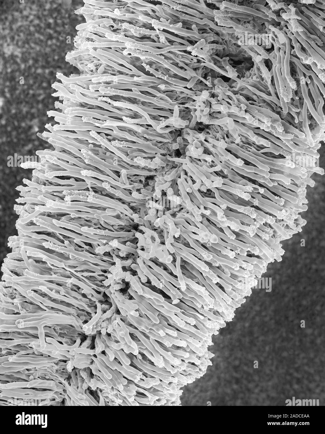 Scanning electron micrograph (SEM) of the bracket fungus basidiocarp ...