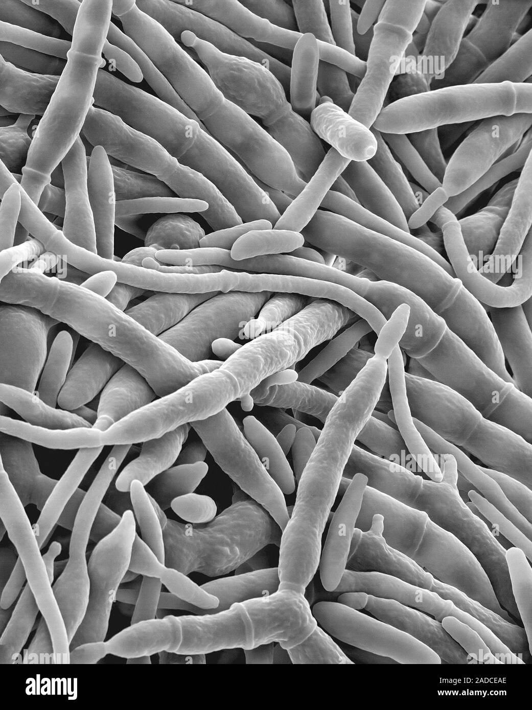 Scanning electron micrograph (SEM) of Filamentous fungus (Fusarium ...