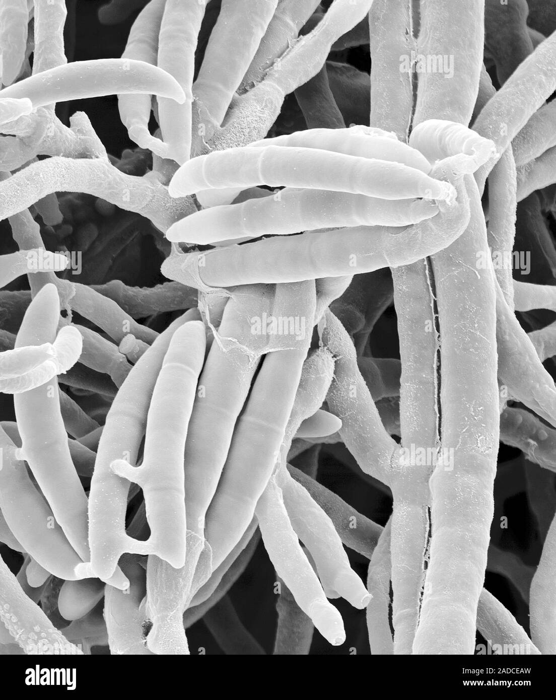 Scanning electron micrograph (SEM) of Filamentous fungus (Fusarium sp ...