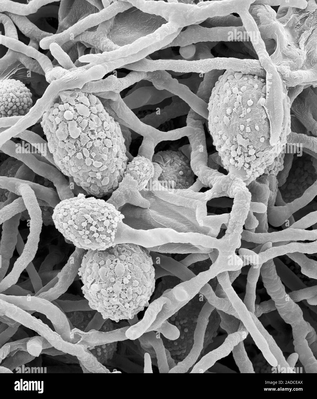 Scanning electron micrograph (SEM) of Hyphae and fruiting structures ...