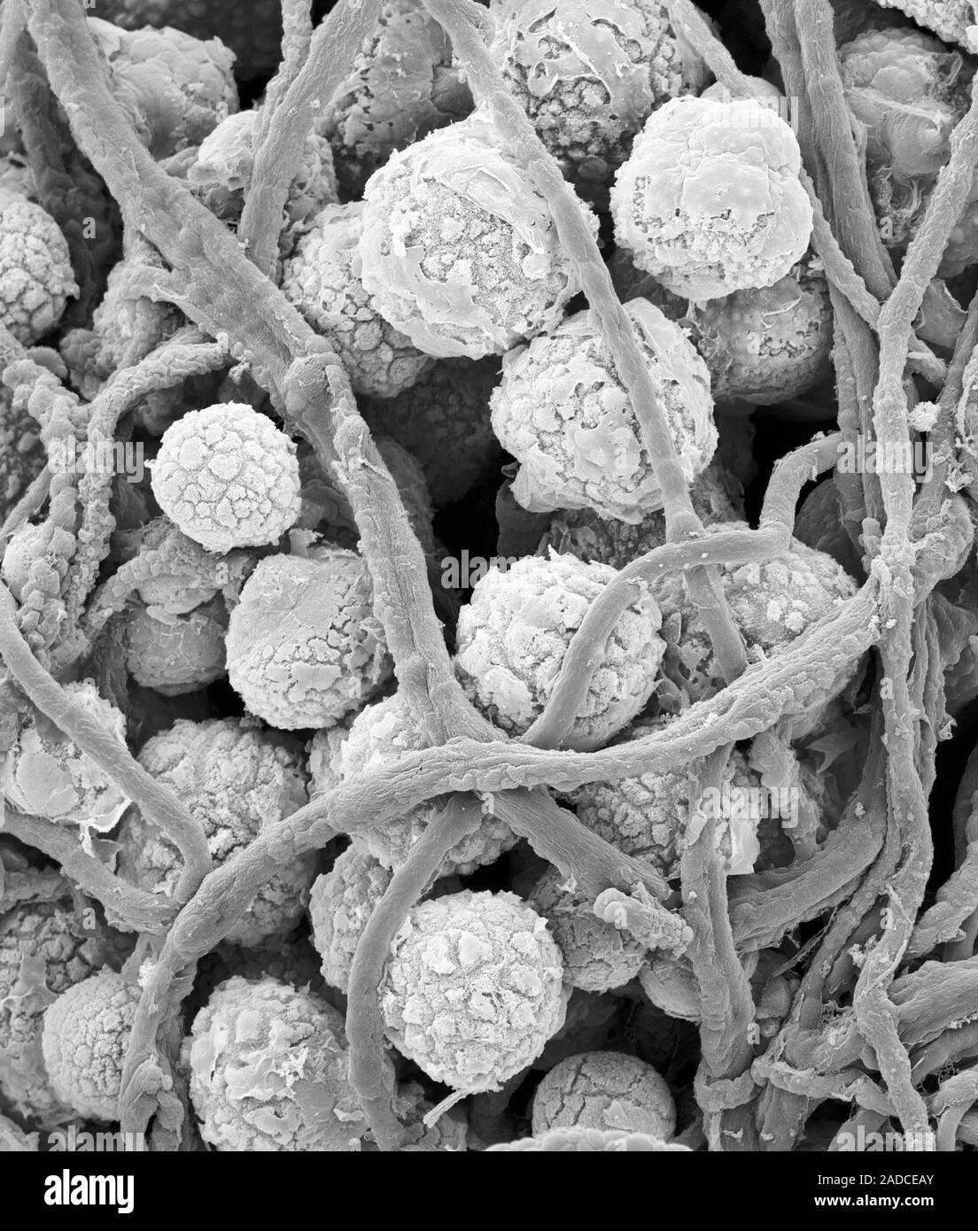 Scanning electron micrograph (SEM) of Mould (Epicoccum nigrum) hyphae ...