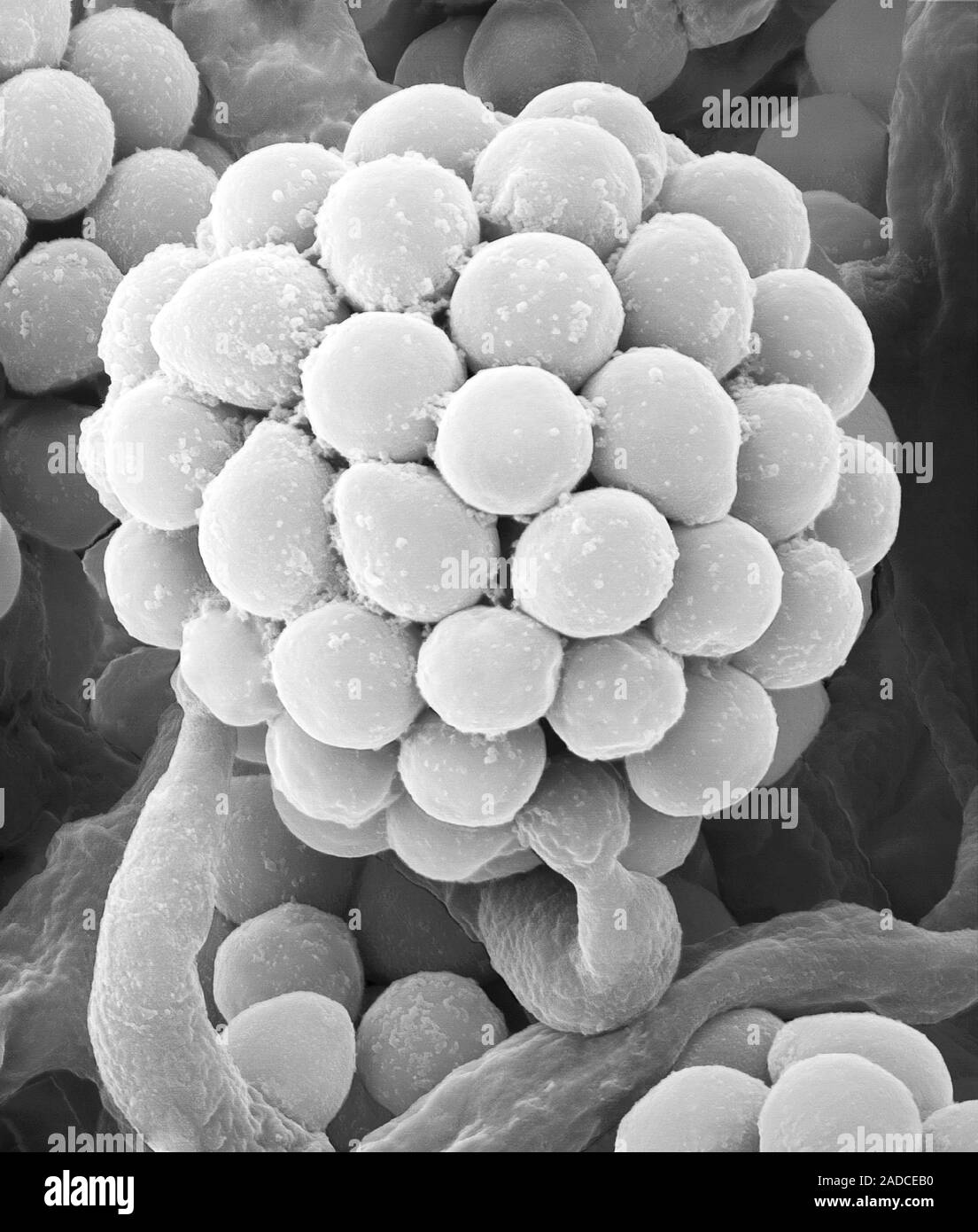 Scanning electron micrograph (SEM) of Soil fungus condiophore and ...