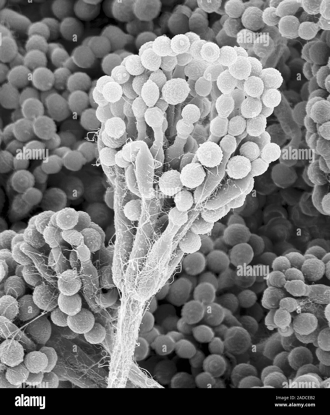 Scanning electron micrograph (SEM) of Mould conidiophores (fruiting structures) and conidia ...