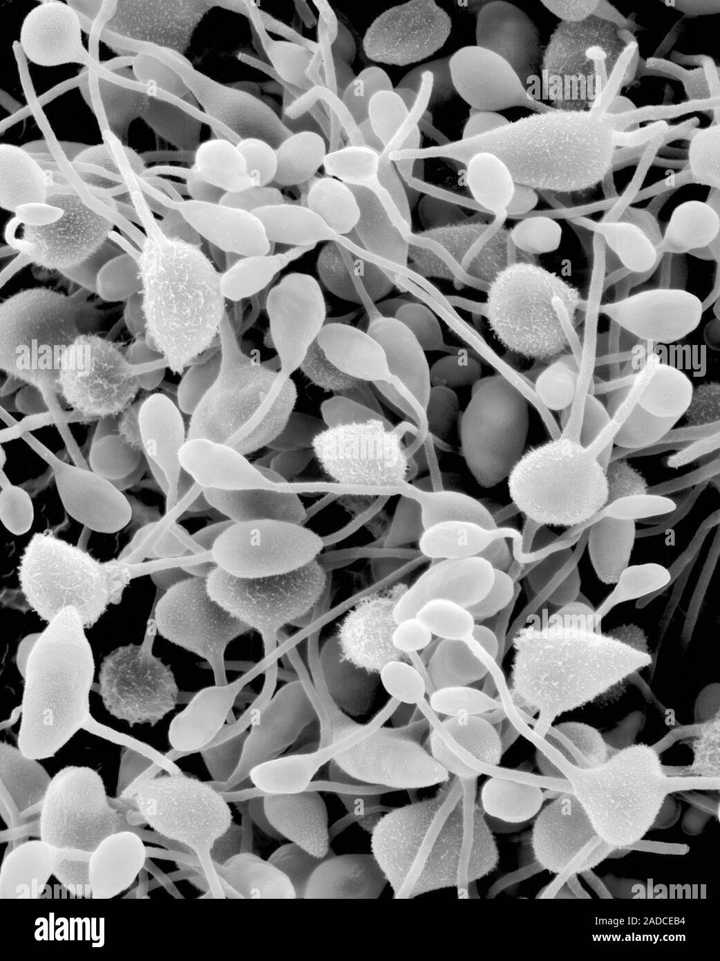 Scanning electron micrograph (SEM) of the basidiomycetous yeast with ...
