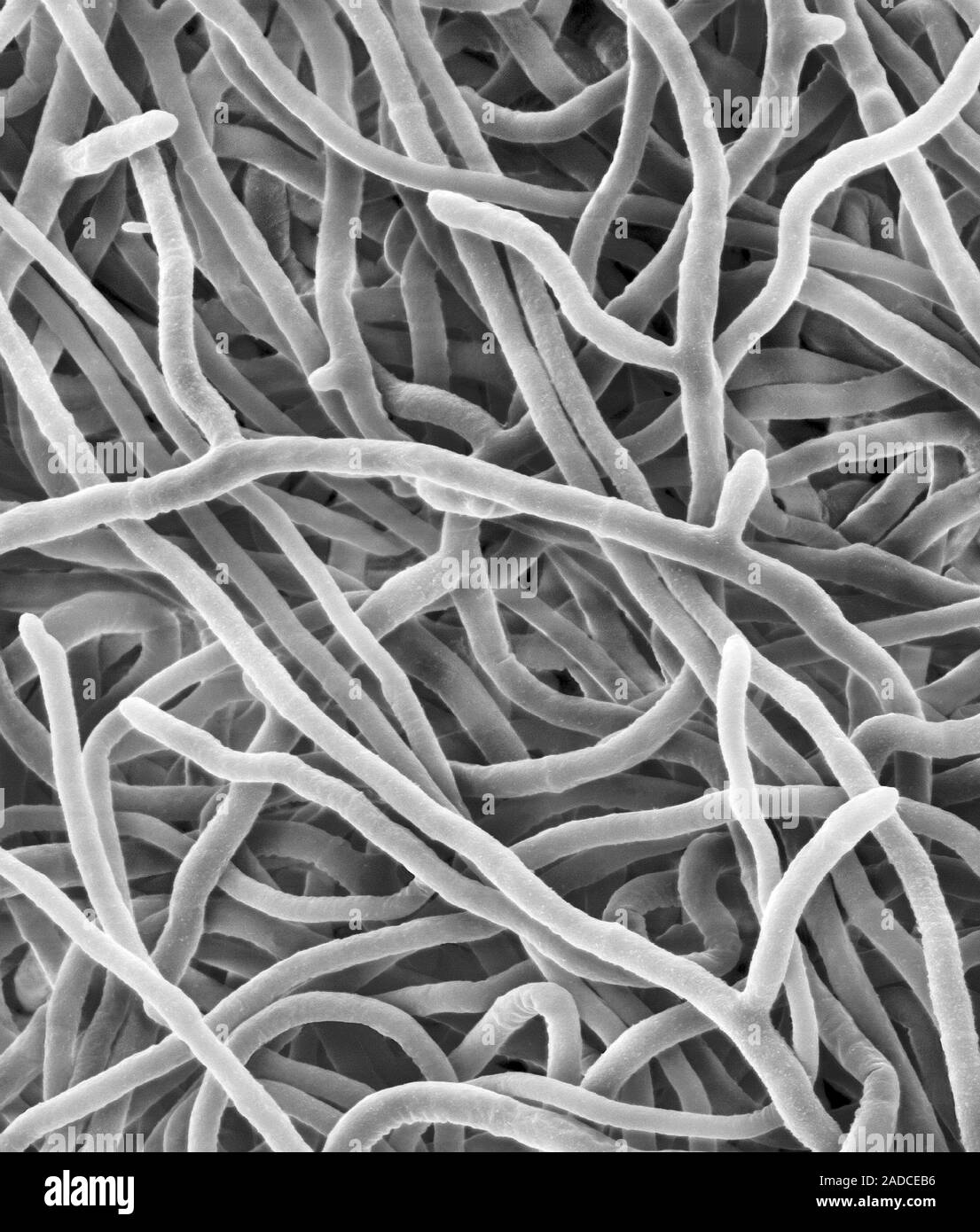 Scanning electron micrograph (SEM) of Hyphae (mycelium) of Trichophyton ...