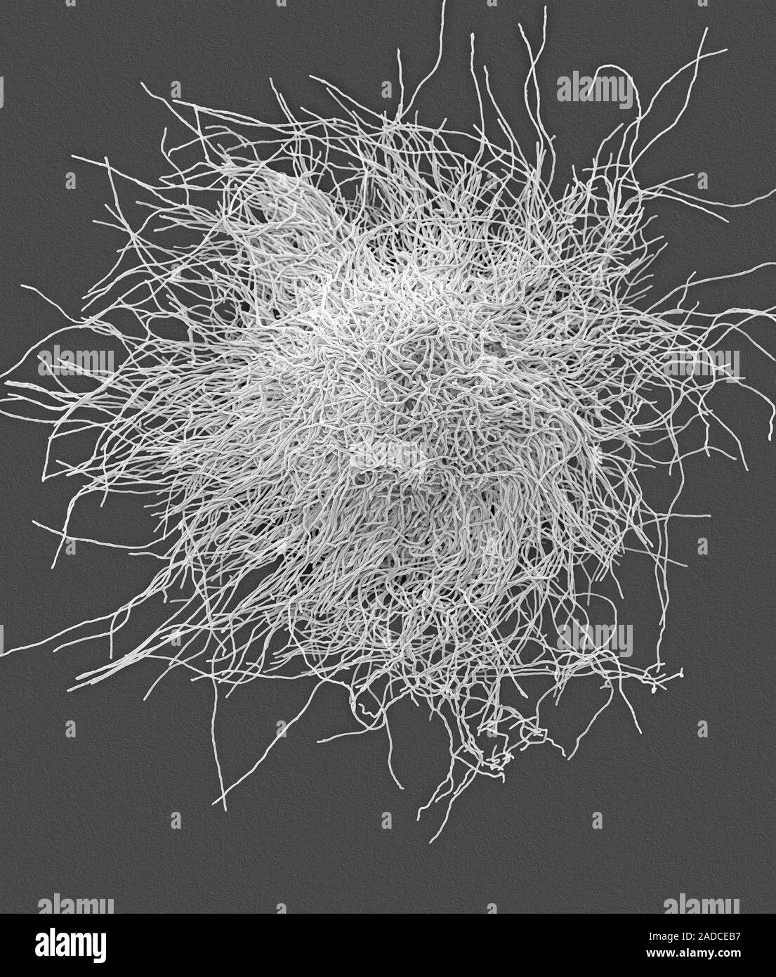 Scanning electron micrograph (SEM) of a fungal colony (mycelium) of ...