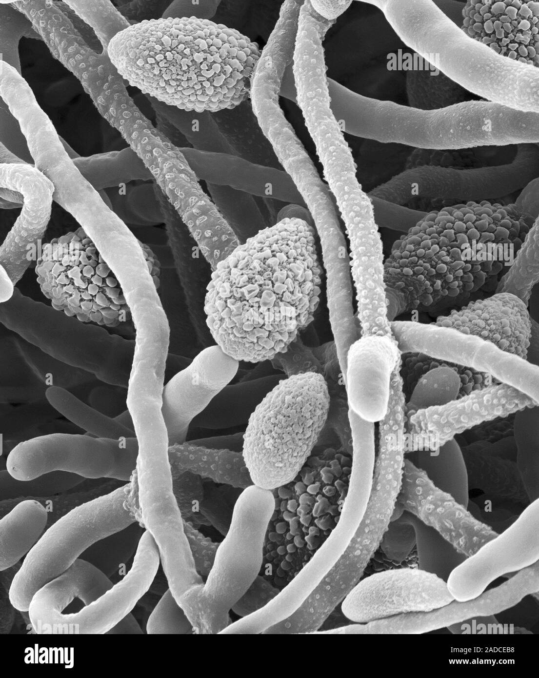 Scanning electron micrograph (SEM) of Sporulating, filamentous fungus ...