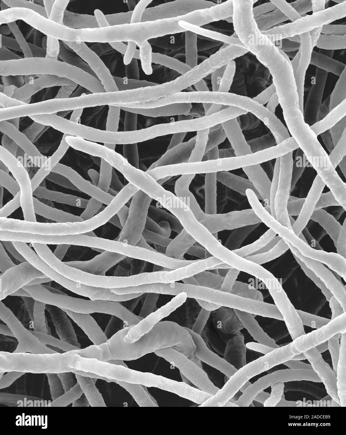 Scanning electron micrograph (SEM) of the branched, filamentous fungus ...