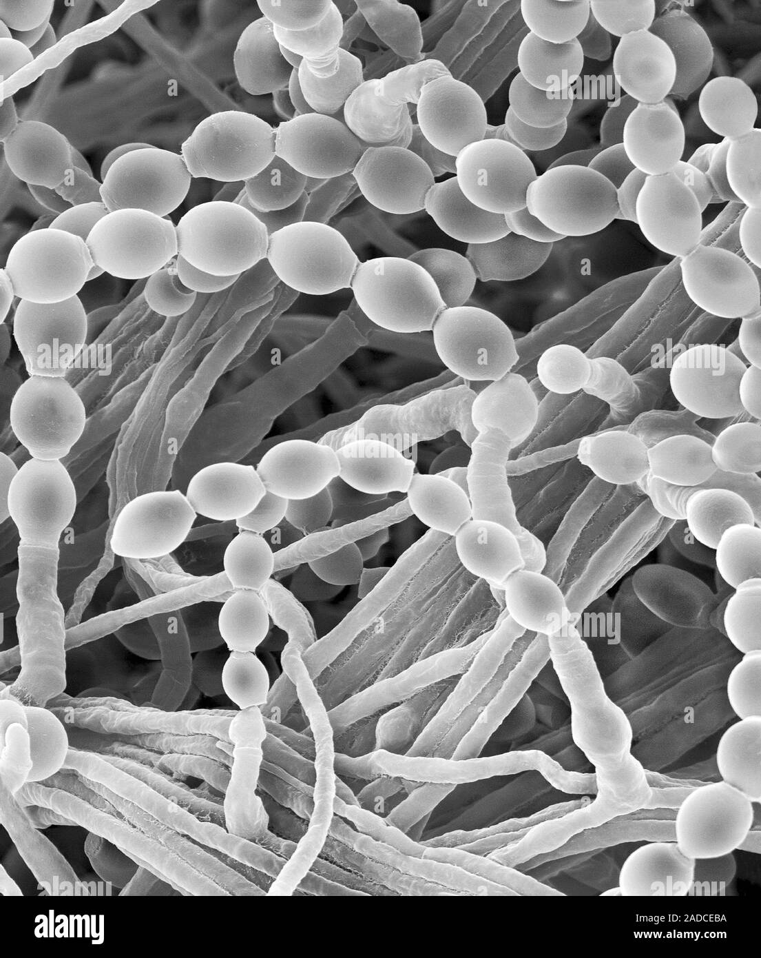 Scanning electron micrograph (SEM) of Hyphae and conidia (spores) of ...