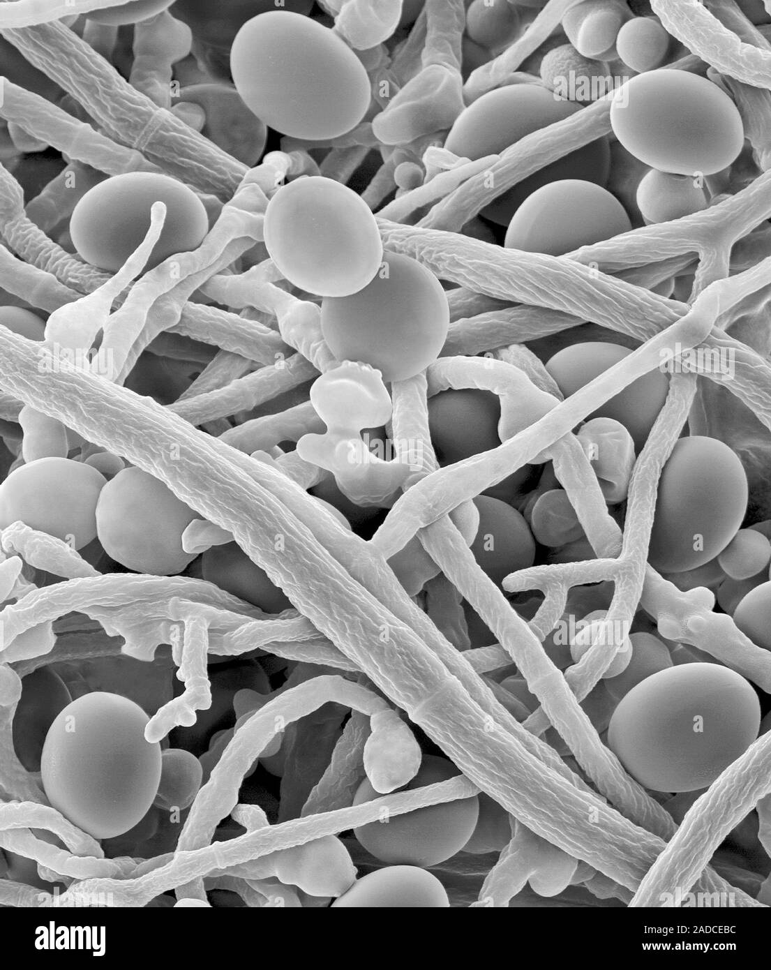 Scanning electron micrograph (SEM) of Sporulating, filamentous fungus ...