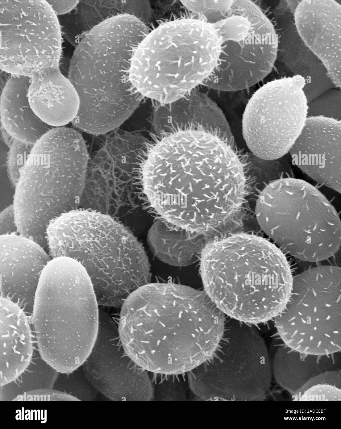 Scanning electron micrograph (SEM) of Hymenomycetous yeast fungus ...