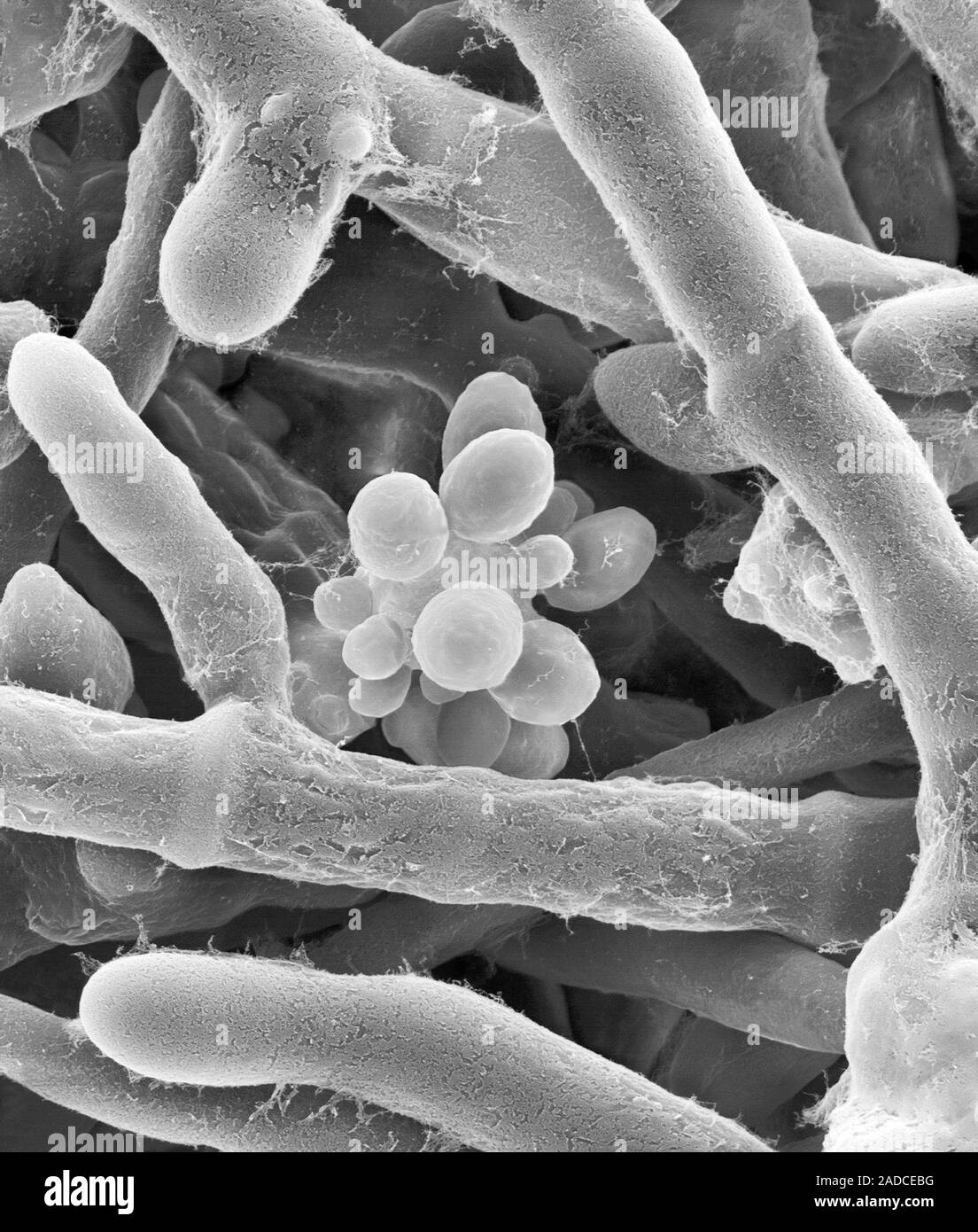 Scanning electron micrograph (SEM) of the common indoor allergenic ...