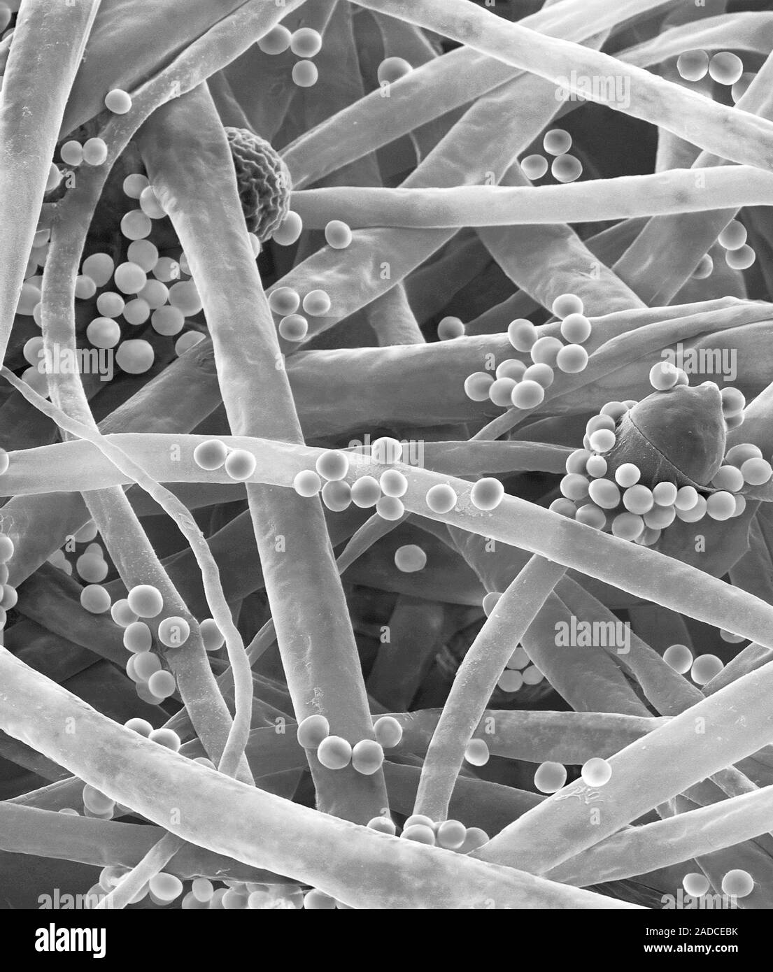 Scanning electron micrograph (SEM) of Hyphae and fruiting structures ...