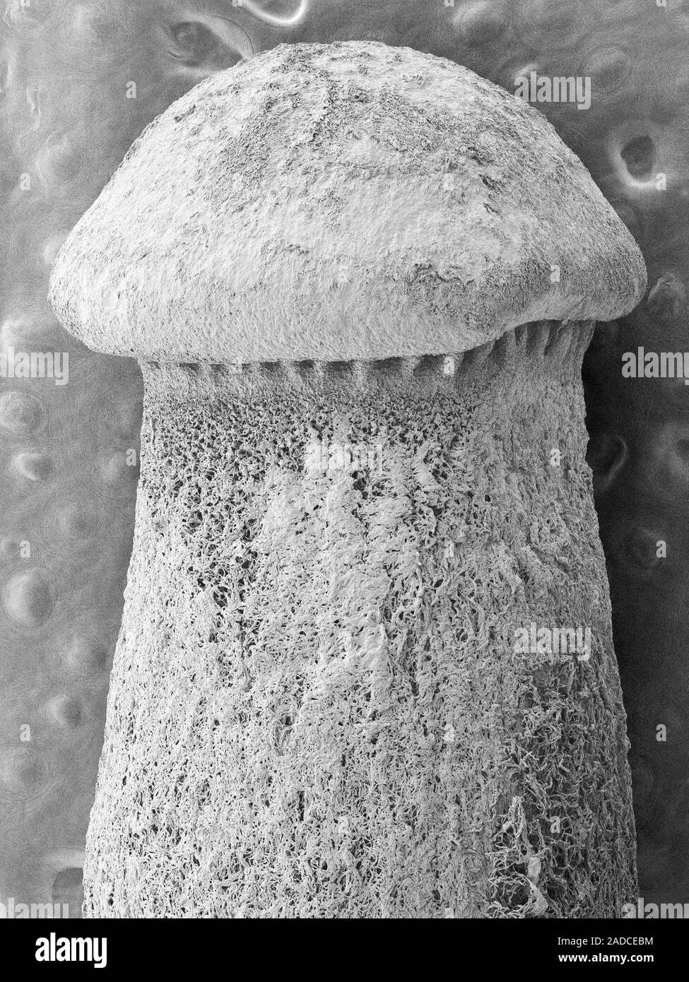 Scanning electron micrograph (SEM) of Mycorrhizal fungus - edible ...