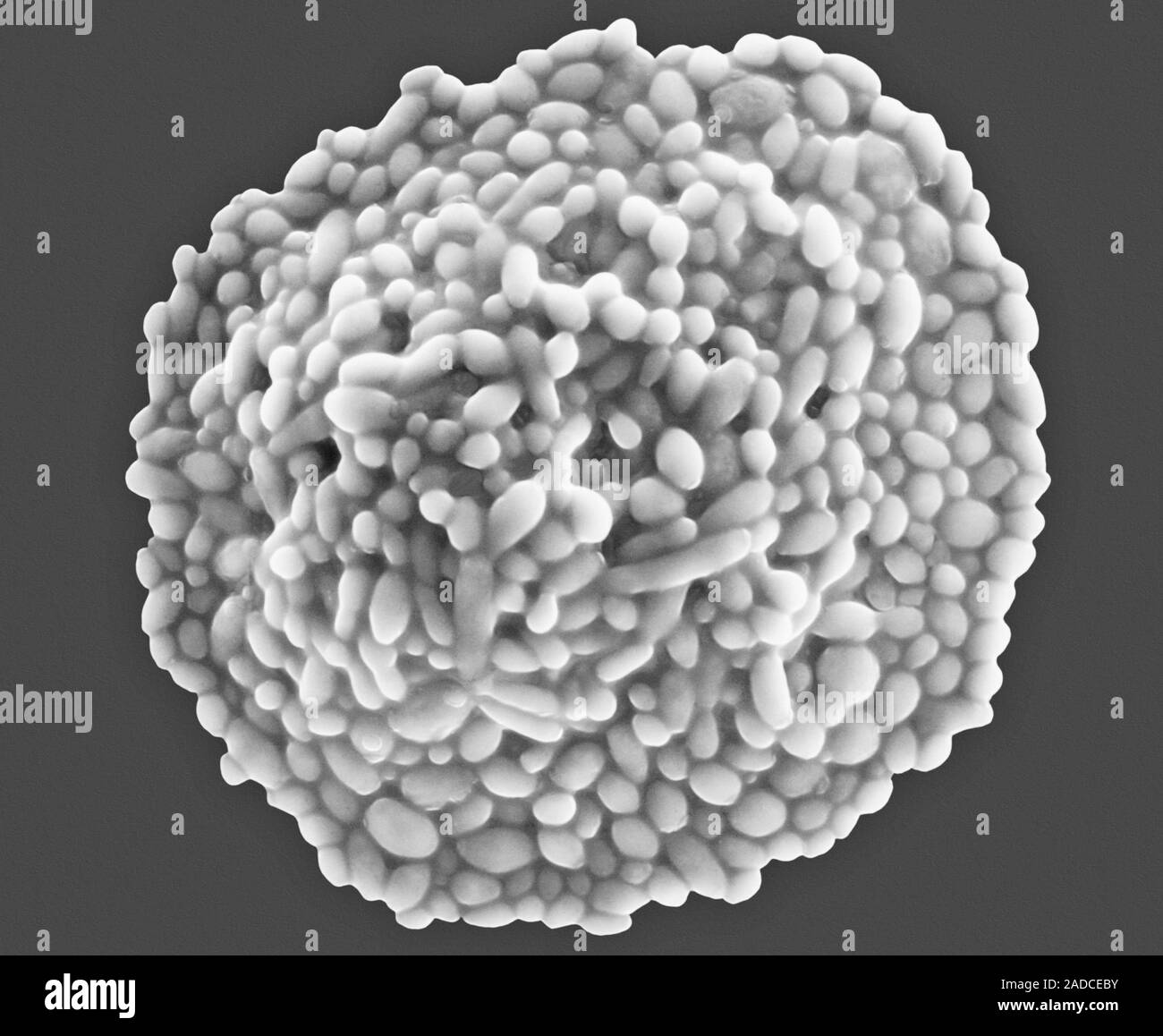 Scanning electron micrograph (SEM) of Yeast Colony (Saccharomyces ...