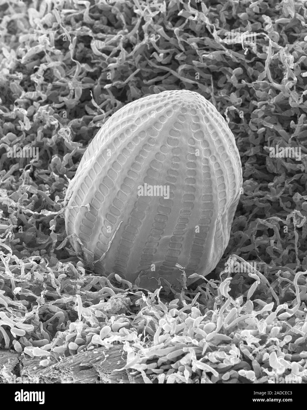 Scanning electron micrograph (SEM) of Monarch butterfly egg (Danaus ... Scanning electron micrograph (SEM) of Monarch butterfly egg (Danaus ...