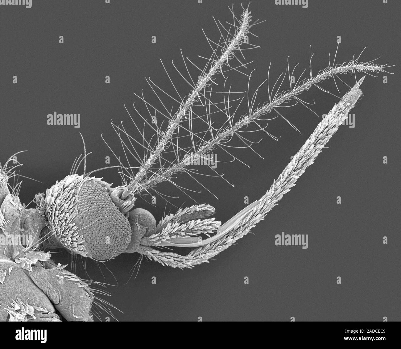 Scanning electron micrograph (SEM) of Female Asian tiger mosquito ...