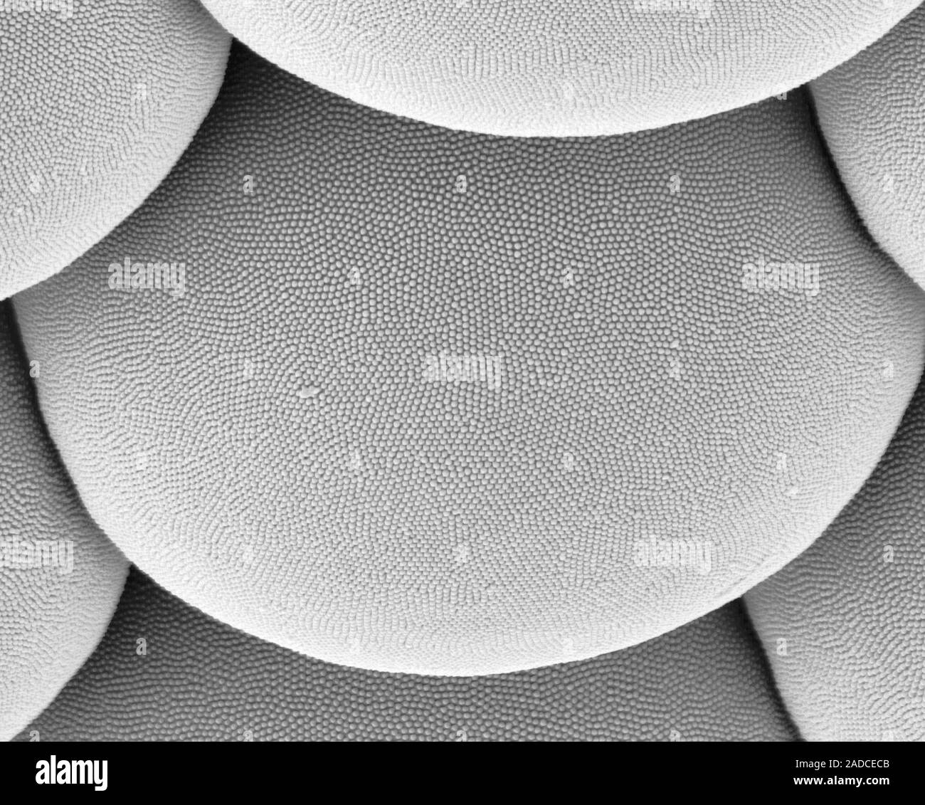 Scanning electron micrograph (SEM) of Female Asian tiger mosquito ...