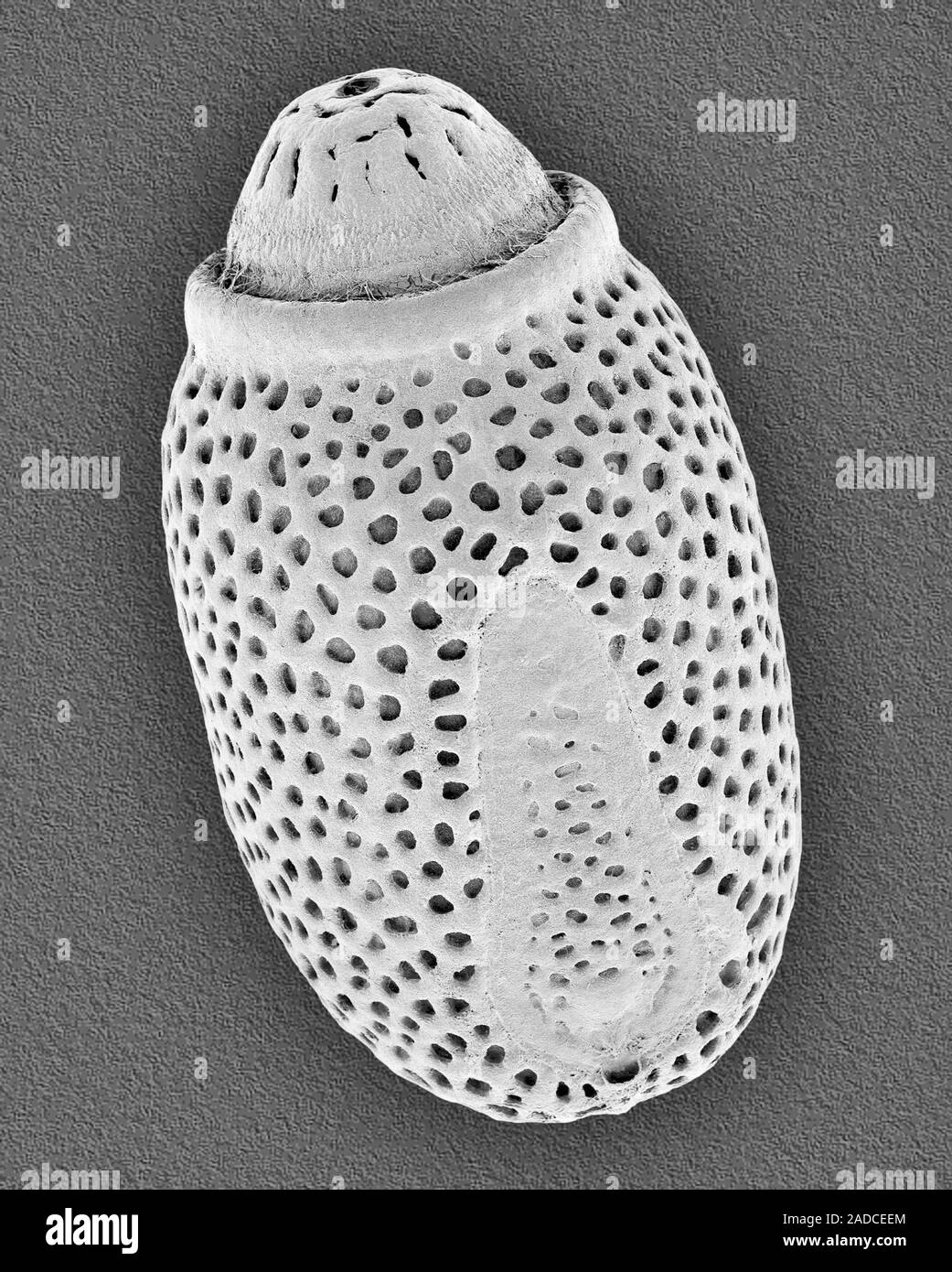 Scanning electron micrograph (SEM) of Walking stick egg case ...