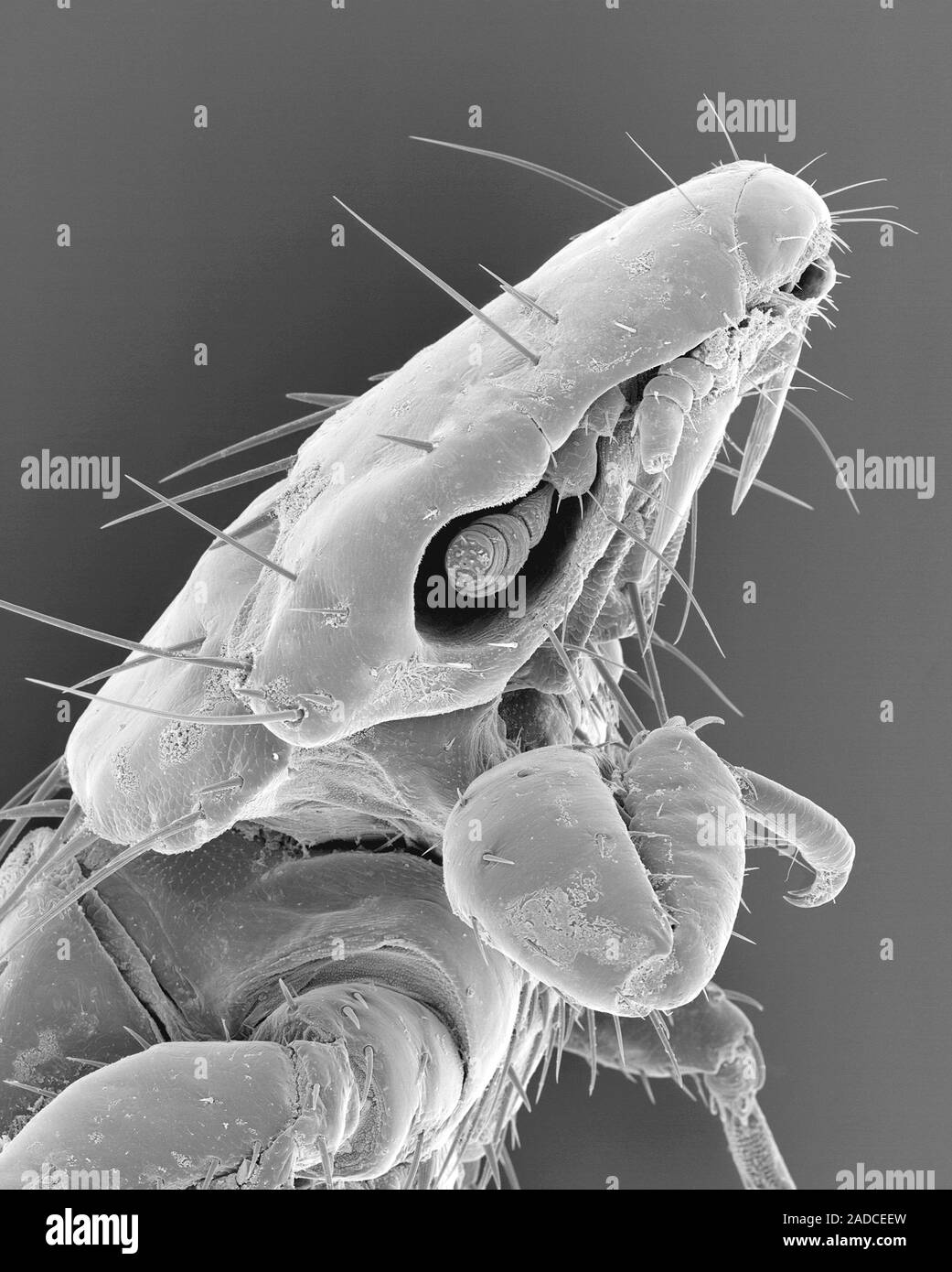Scanning electron micrograph (SEM) of Dog chewing louse (Heterodoxus spiniger). Female lice ...