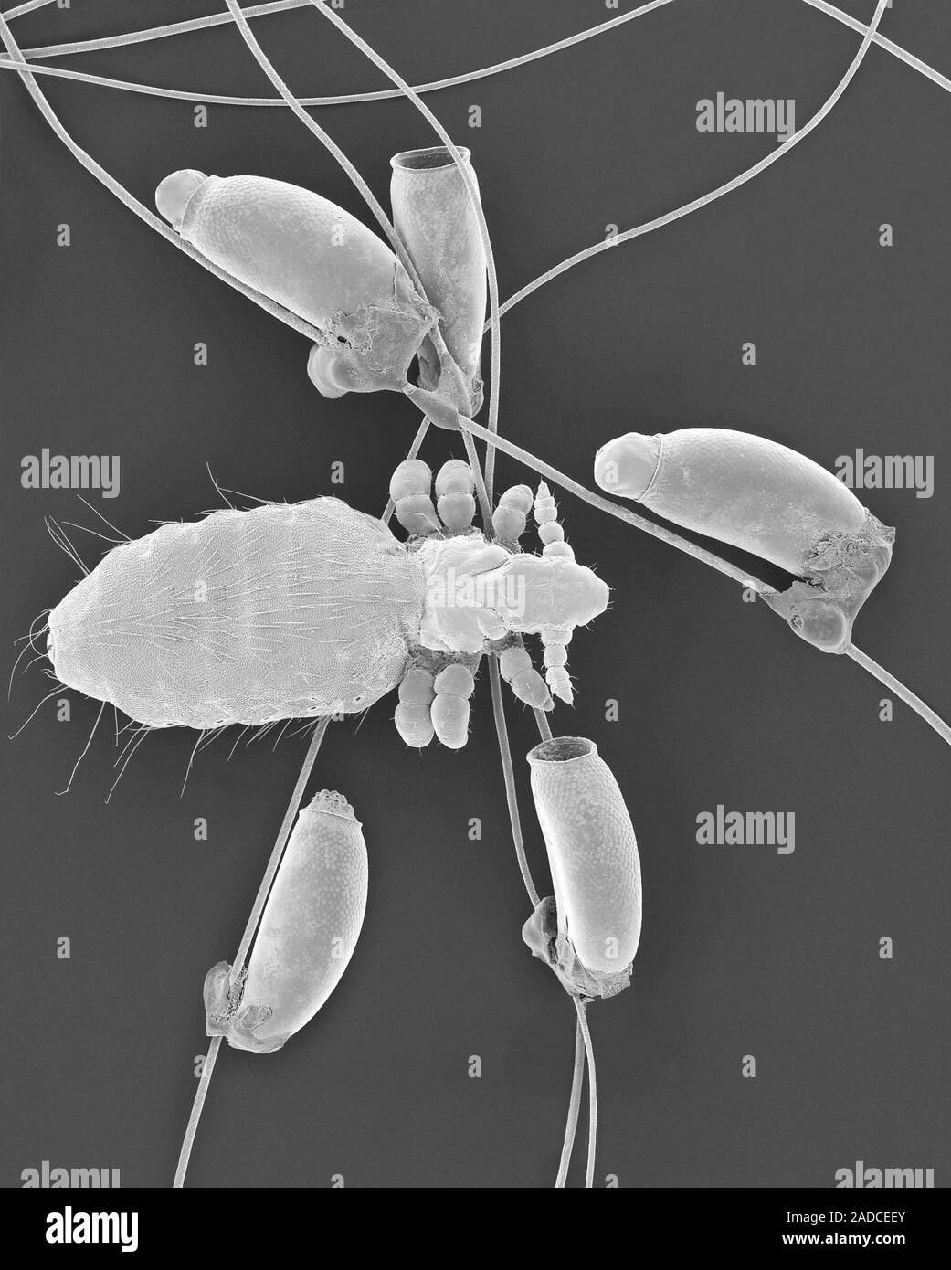 Scanning electron micrograph (SEM) of Long-nosed cattle louse ...