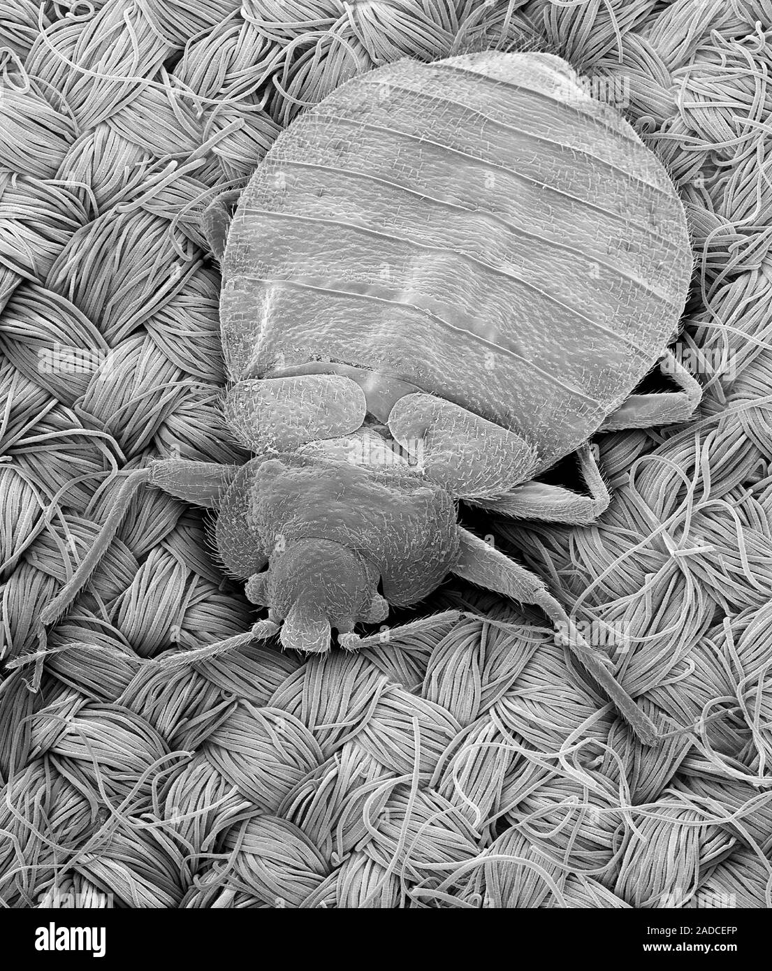 Scanning electron micrograph (SEM) of Bed bug (Cimex lectularius) on ...