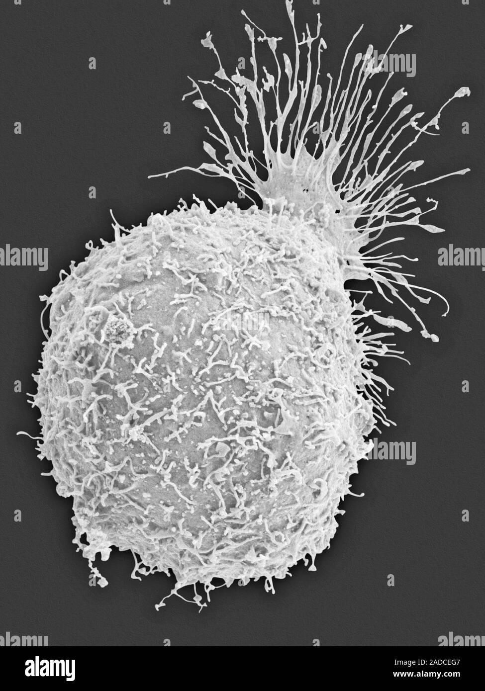 Scanning Electron Micrograph Sem Of An Insect Ovary Cell This Insect