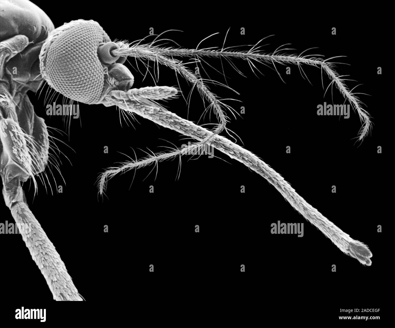 Scanning electron micrograph (SEM) of Female mosquito head (Aedes ...
