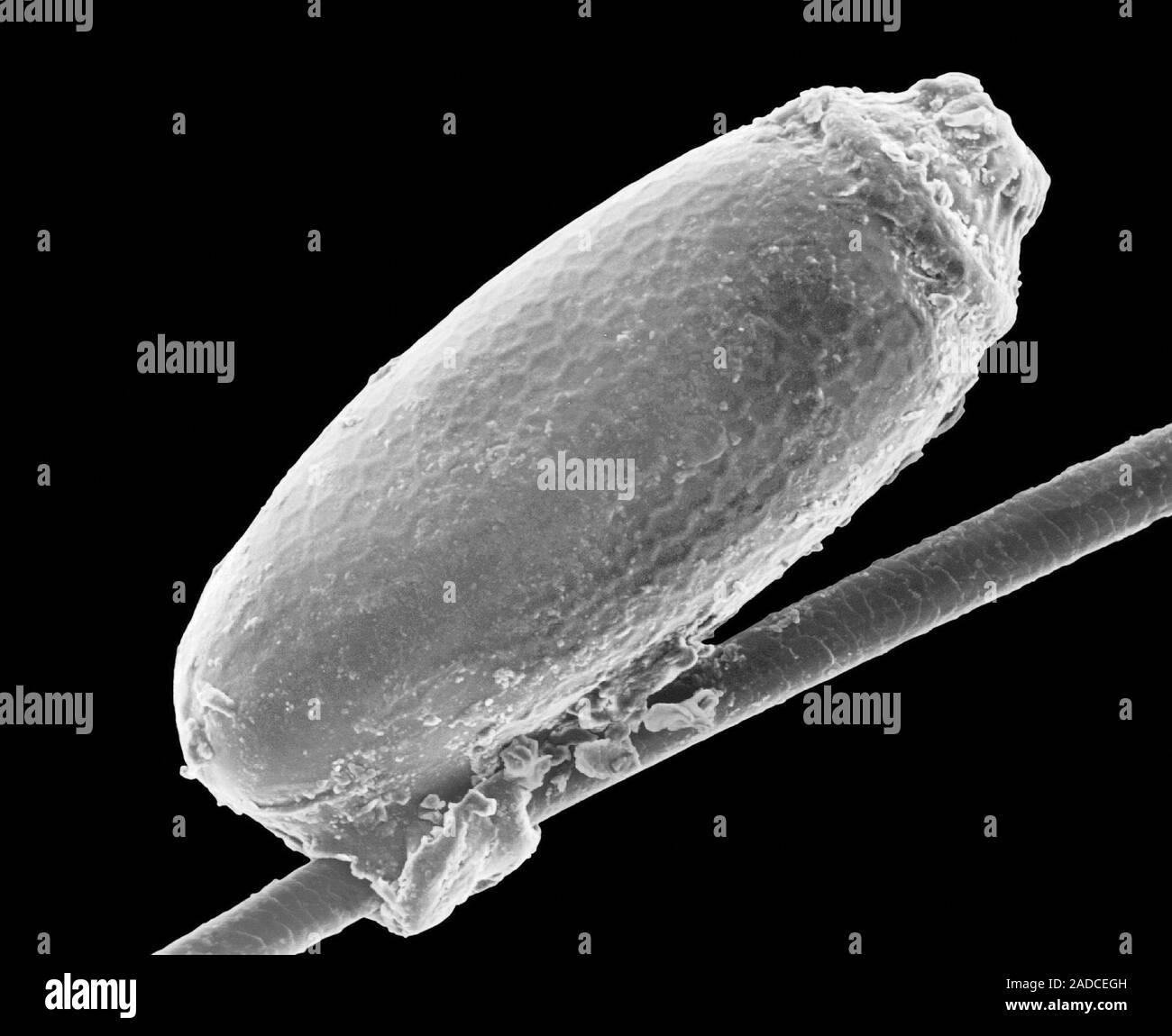 Scanning electron micrograph (SEM) of Louse egg case attached to a ...