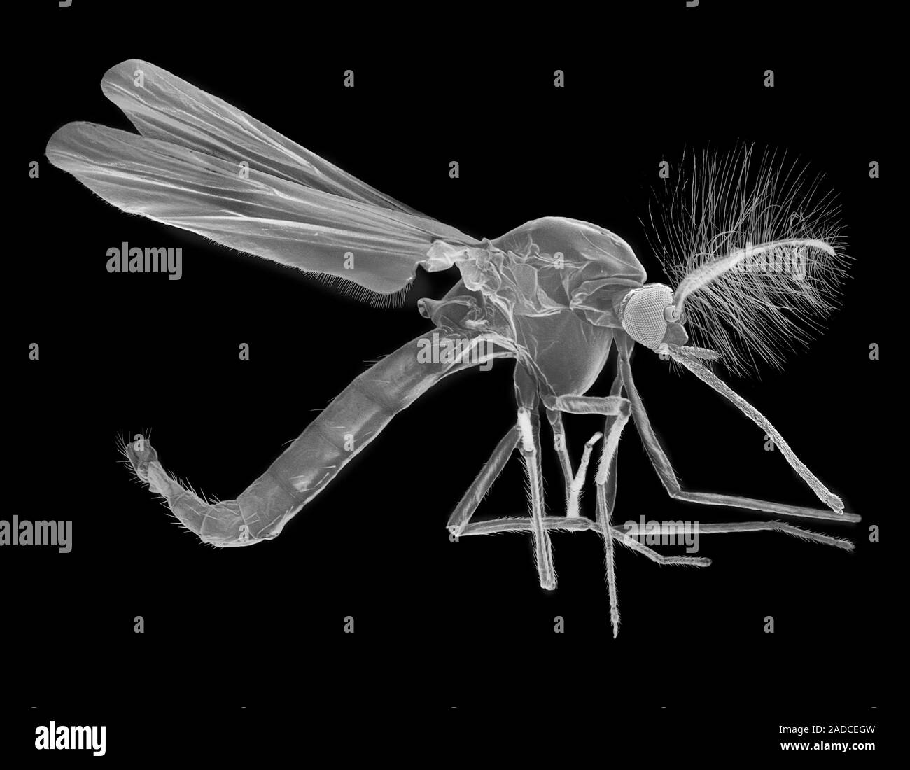Scanning electron micrograph (SEM) of male mosquito (Anopheles ...