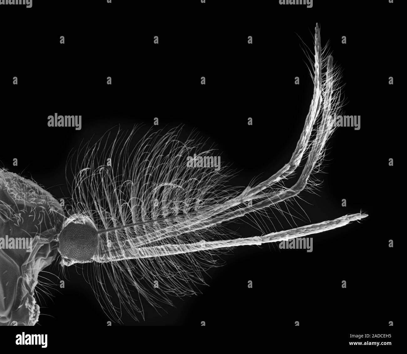 Scanning electron micrograph (SEM) of Male mosquito (Anopheles ...