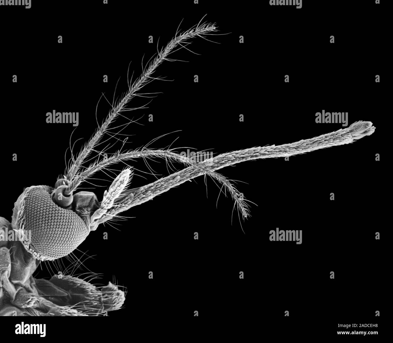 Scanning electron micrograph (SEM) of Female mosquito head (Aedes ...