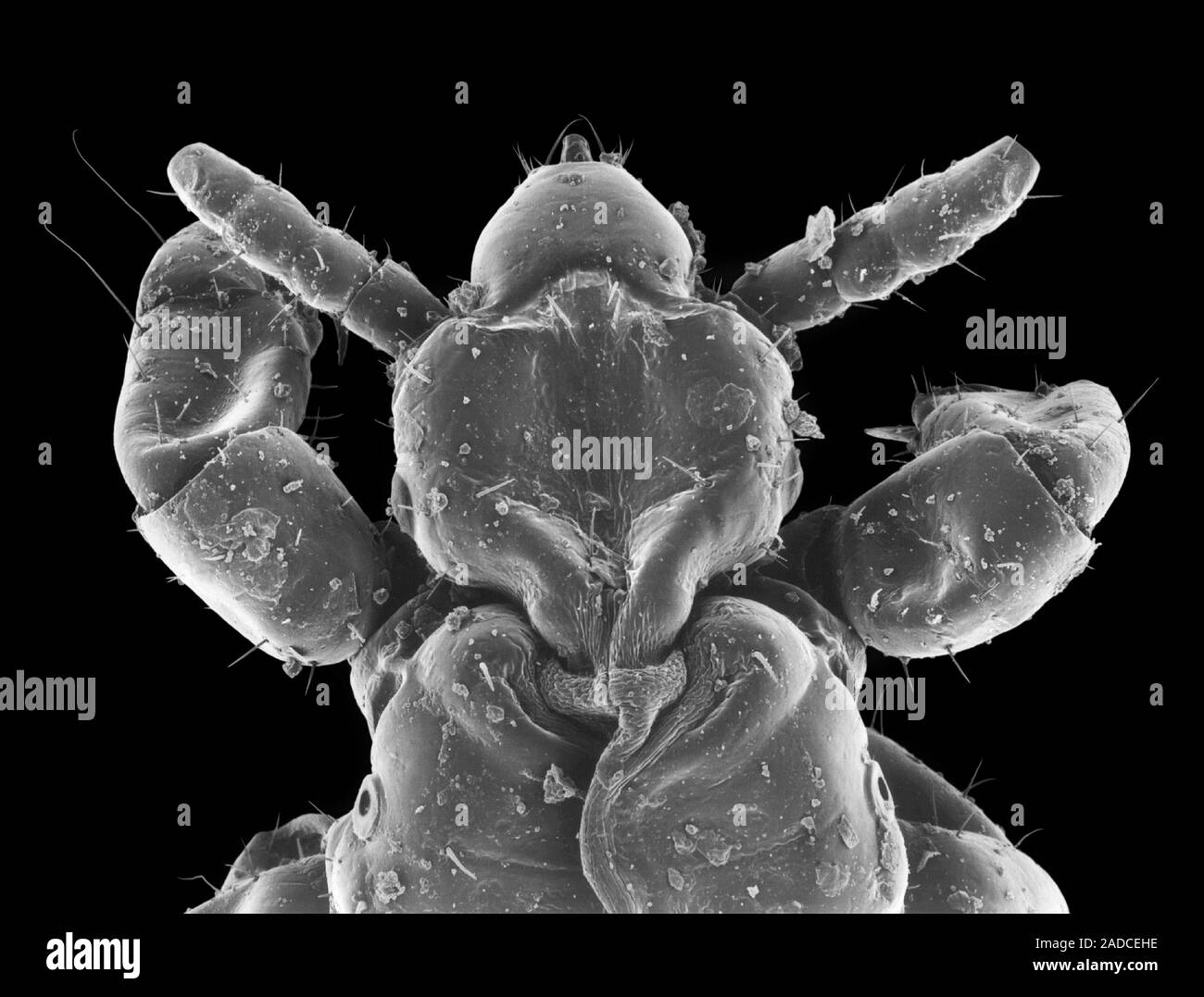 Scanning electron micrograph (SEM) of Human head louse (Pediculus ...