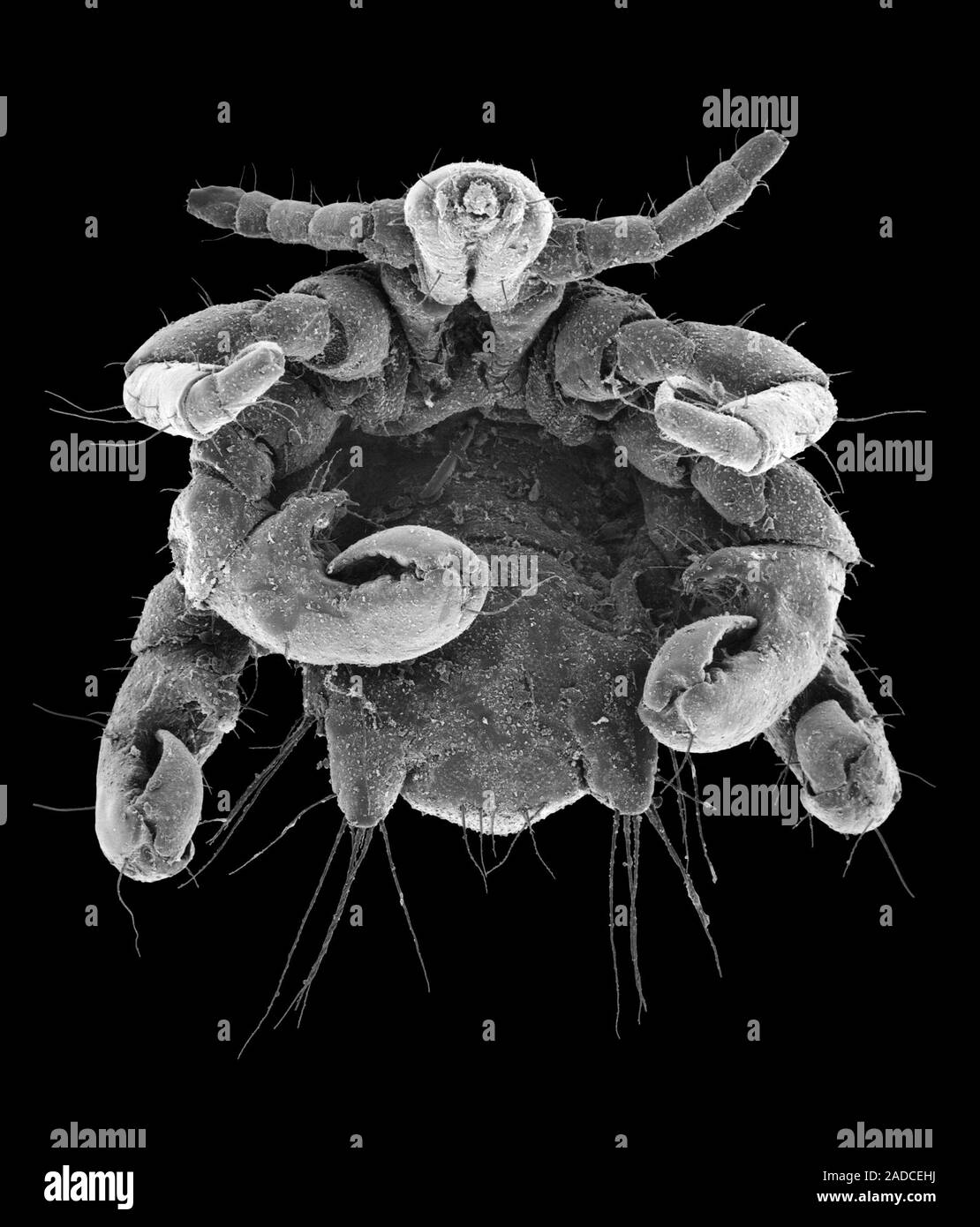 Scanning electron micrograph (SEM) of Pubic louse -Pthirus pubis. The ...