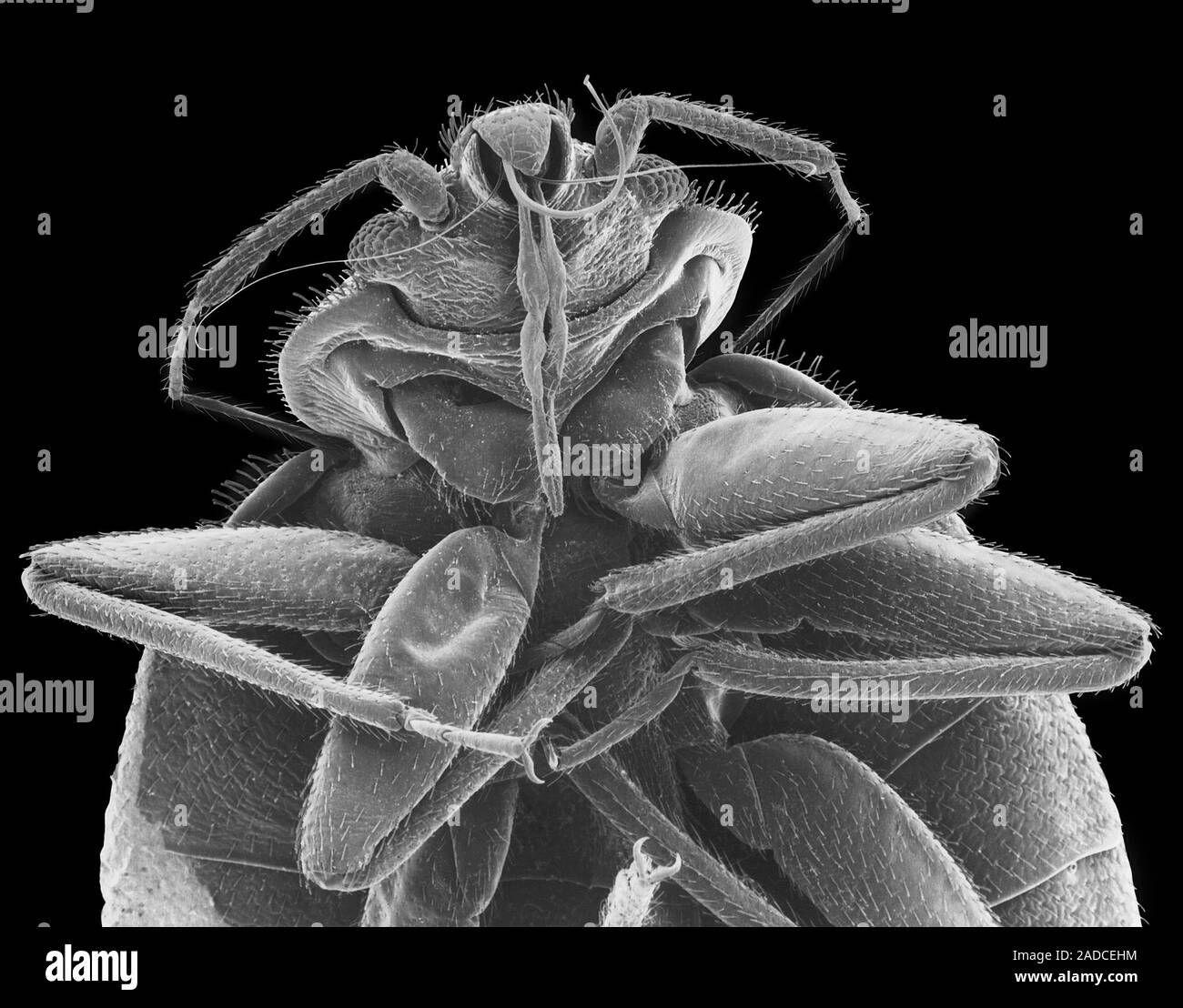 Scanning electron micrograph (SEM) of Bed bug head and upper thorax ...