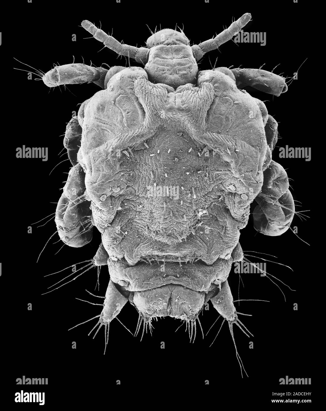 Scanning electron micrograph (SEM) of Pubic louse -Pthirus pubis. The ...
