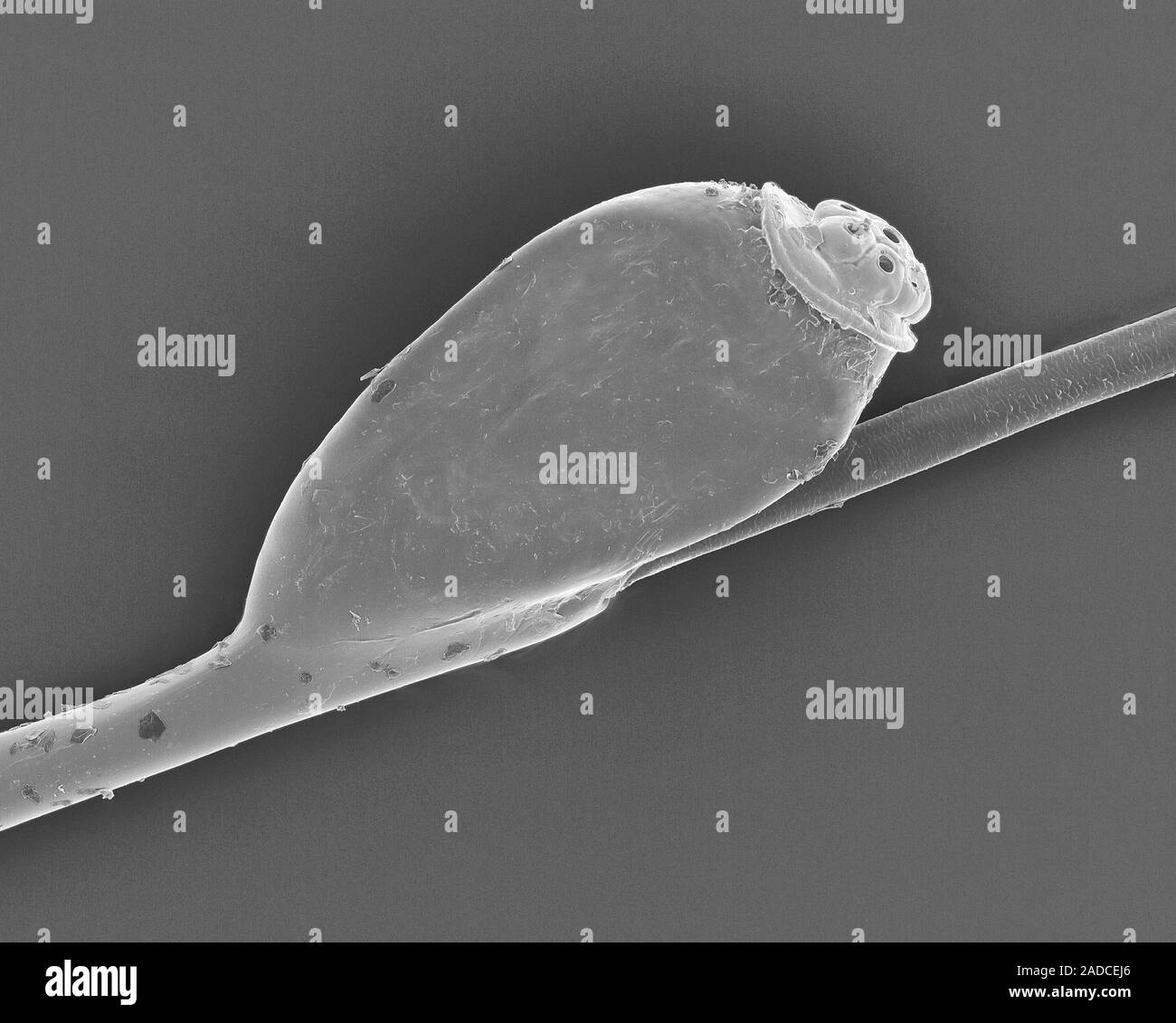Scanning electron micrograph (SEM) of Human head louse egg case on ...