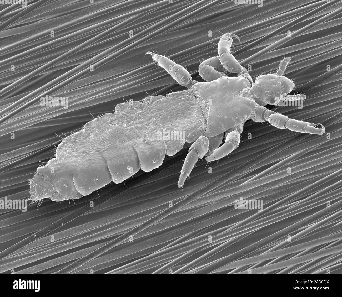 Scanning electron micrograph (SEM) of Human head louse on human hair ...