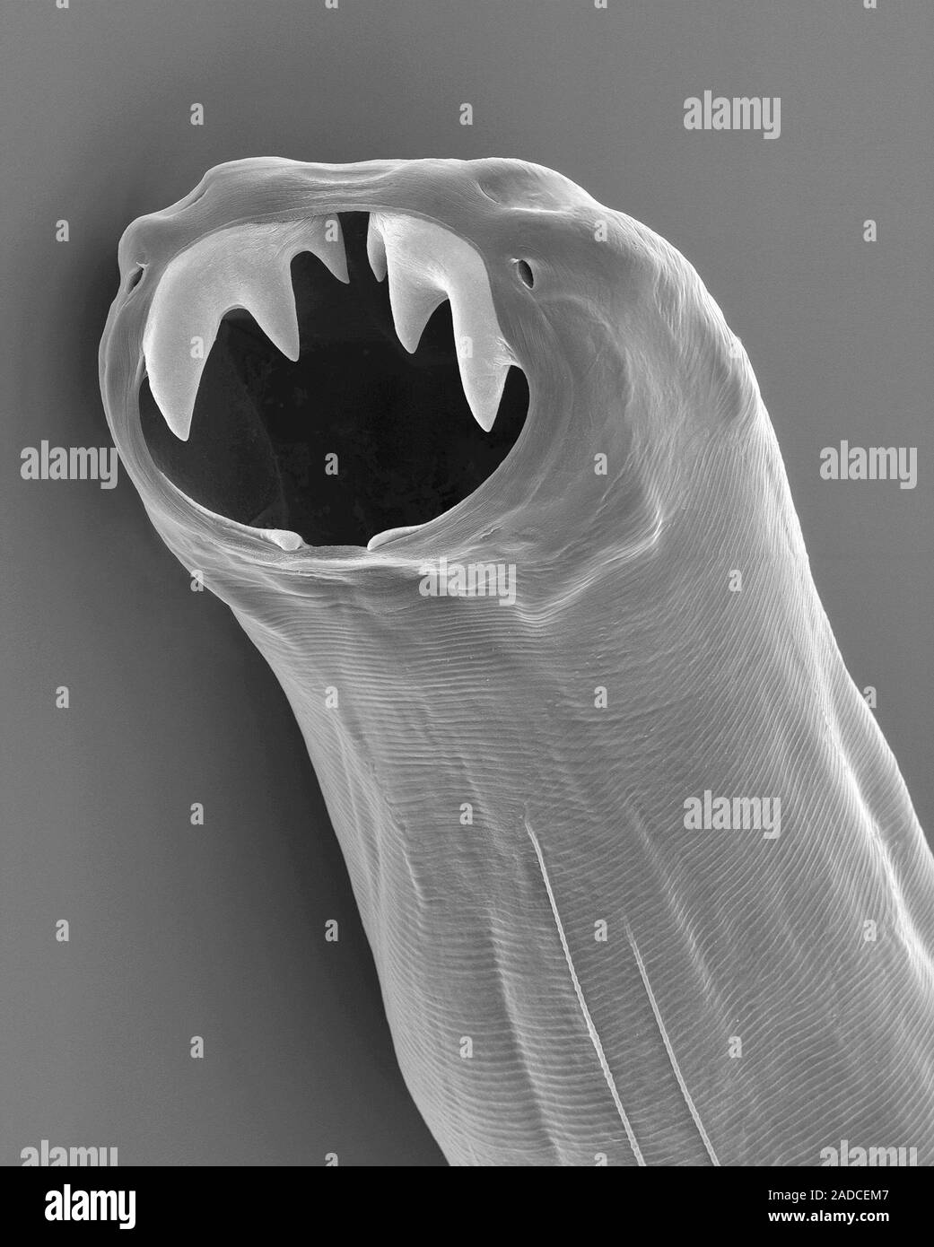 Scanning electron micrograph (SEM) of Dog hookworm buccal capsule ...